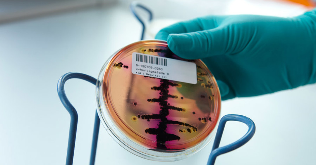 Salmonella Surveillance